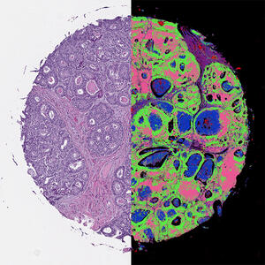 Hybrid microscope could make digital biopsies more accessible to labs ...